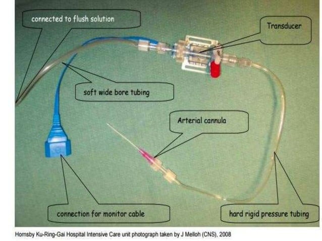 Arterial lines by Dr.Tinku Joseph | PPTX | First Aid | Injuries