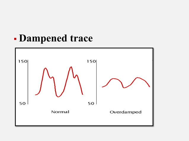 Arterial lines by Dr.Tinku Joseph | PPTX | First Aid | Injuries