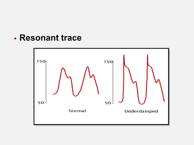Arterial lines by Dr.Tinku Joseph | PPTX | First Aid | Injuries