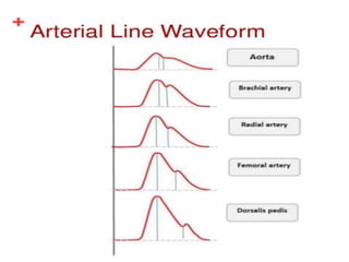 Arterial lines by Dr.Tinku Joseph | PPT