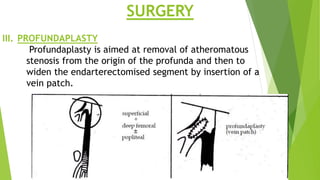 Arterial arterial occlusion | PPTX