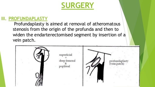 Arterial arterial occlusion