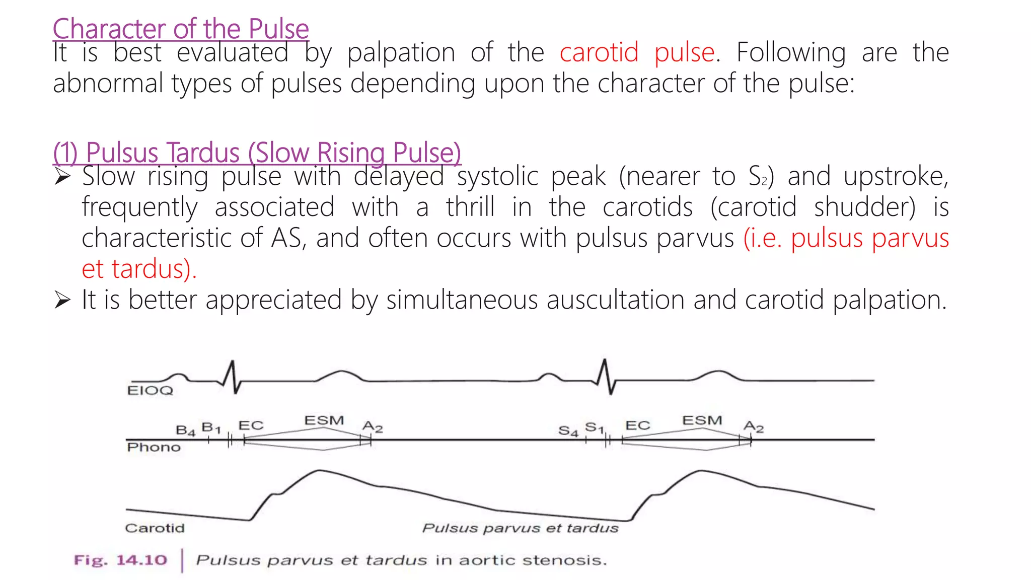 arterial pulse.pptx | Death, Injury, or Military Conflict | Sensitive Topics