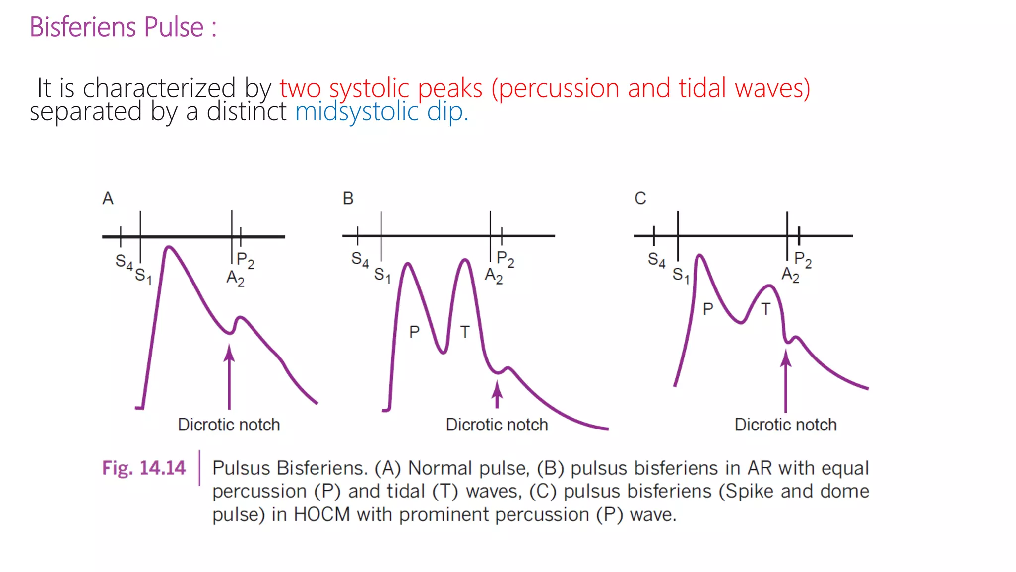 arterial pulse.pptx