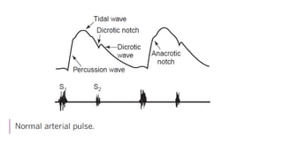 Carotid Pulse Wave