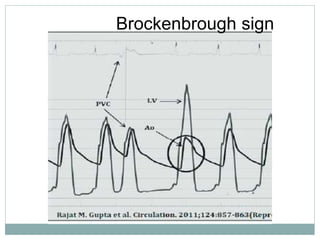 arterial pulse abhishek.ppt