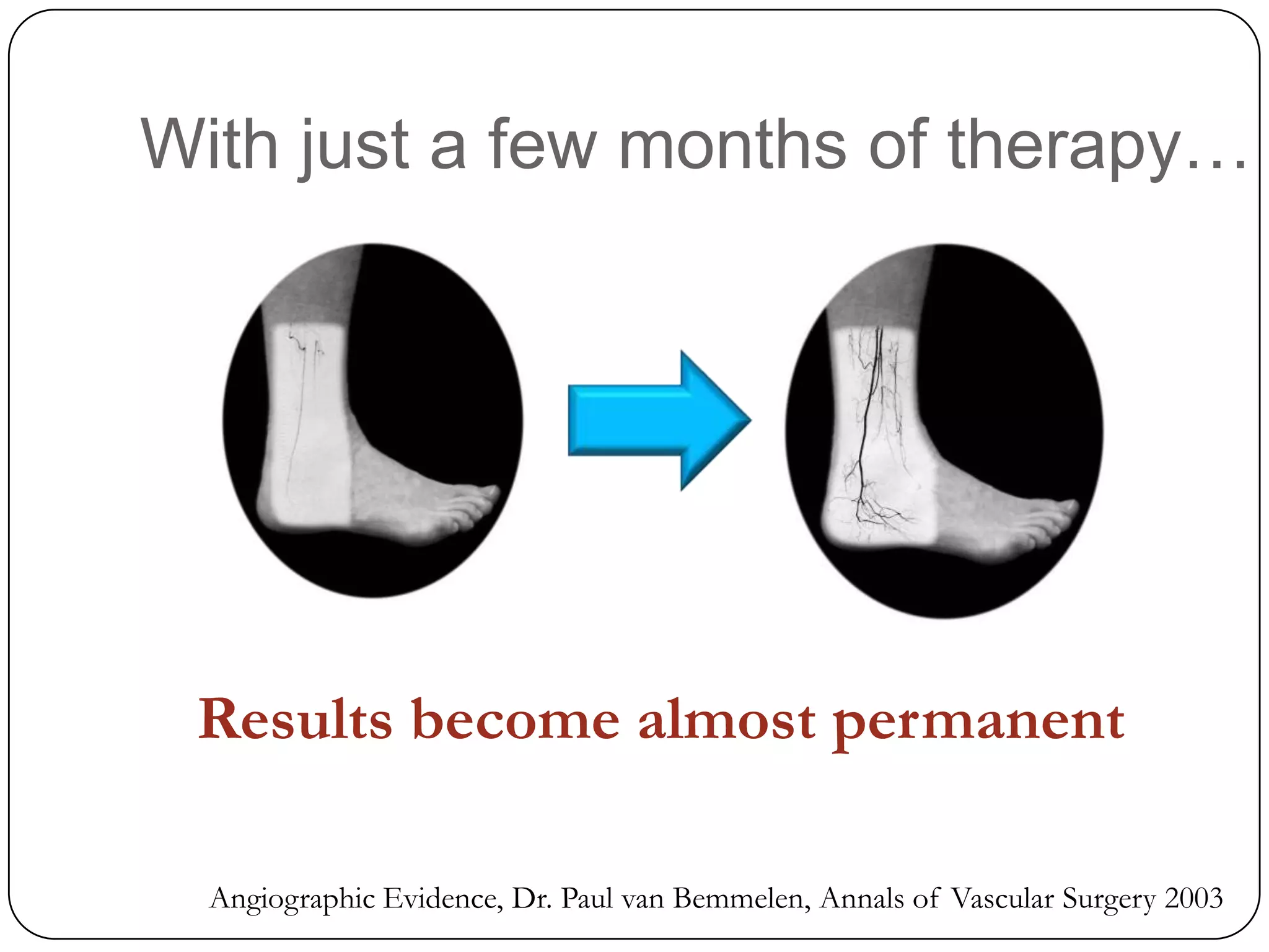 Importance of Arterial Pump Compression & Decompression Rates | PPTX ...