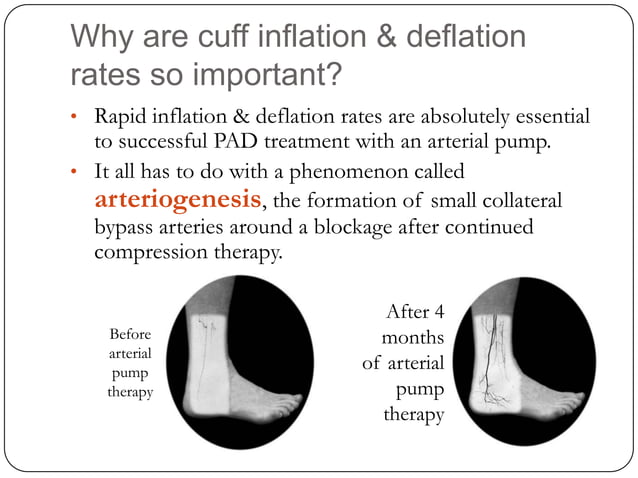 Importance of Arterial Pump Compression & Decompression Rates | PPTX ...