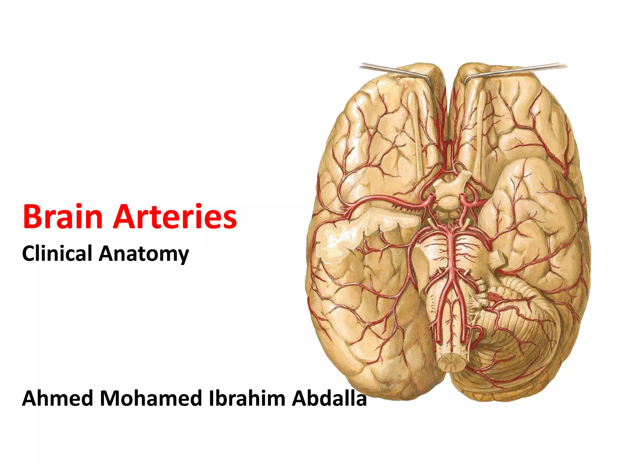 Arterial supply of brain | PPTX