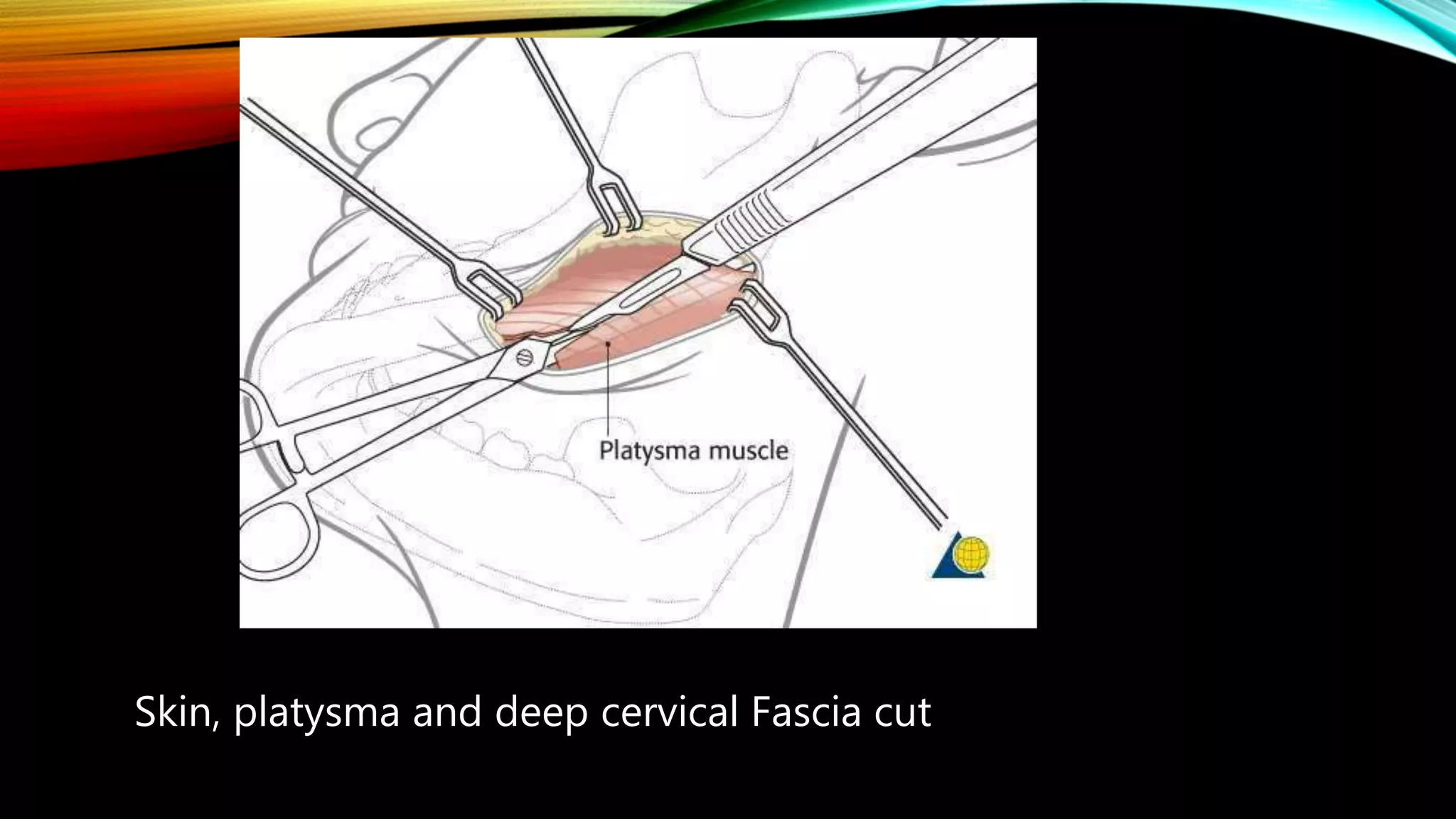 Arterial supply of head and neck | PPTX