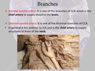 ARTERIAL SUPPLY OF HEAD AND NECK (1)-1.pptx