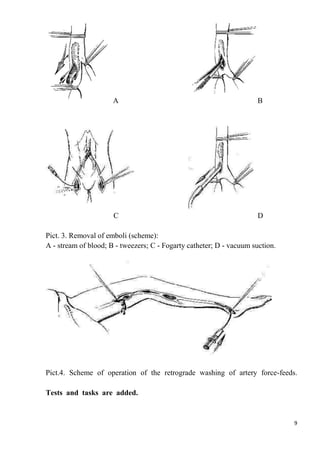 Arterial_thrombosis_and_embolism-1.pdf | First Aid | Injuries