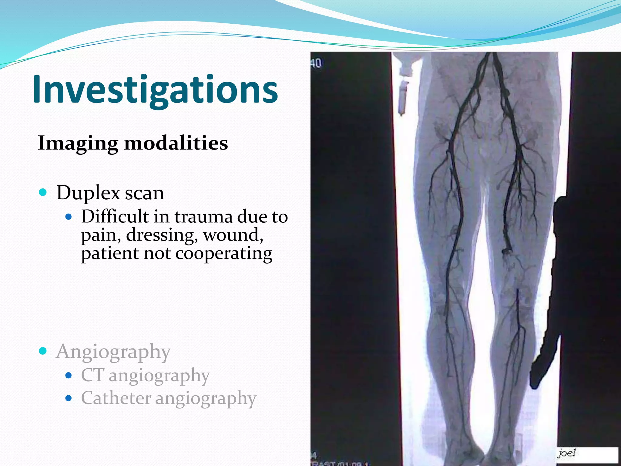 Arterial trauma | PPTX