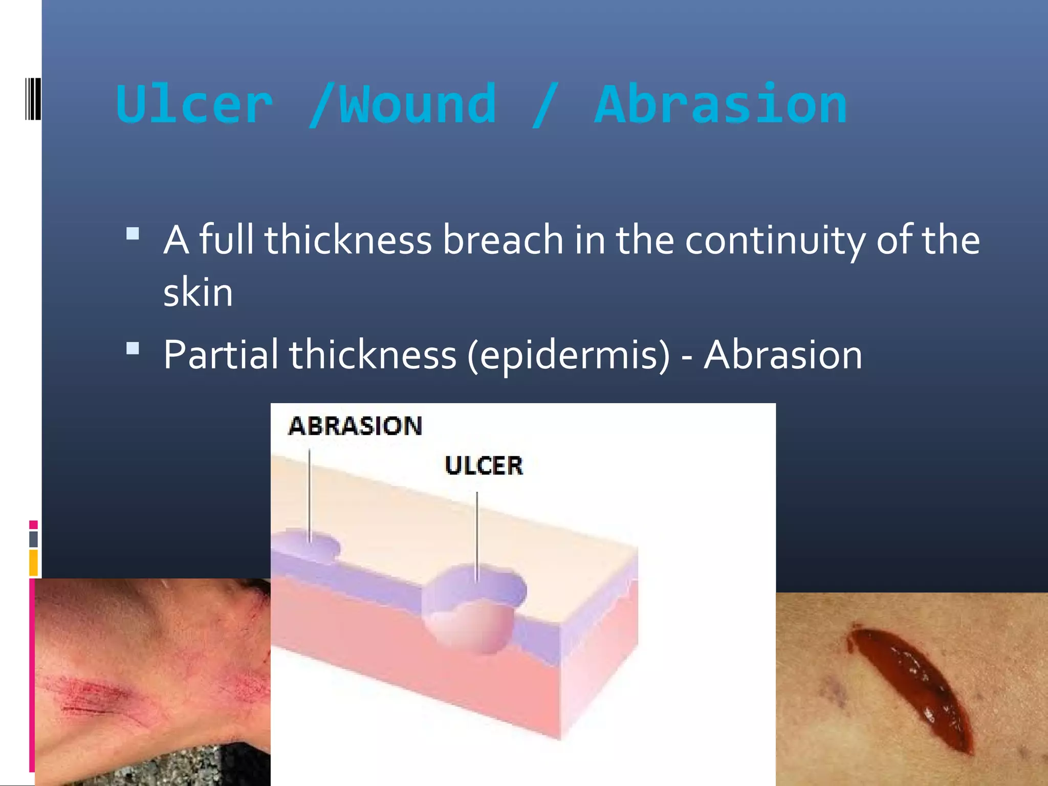 Arterial ulcers by joel arudchelvam | PPT