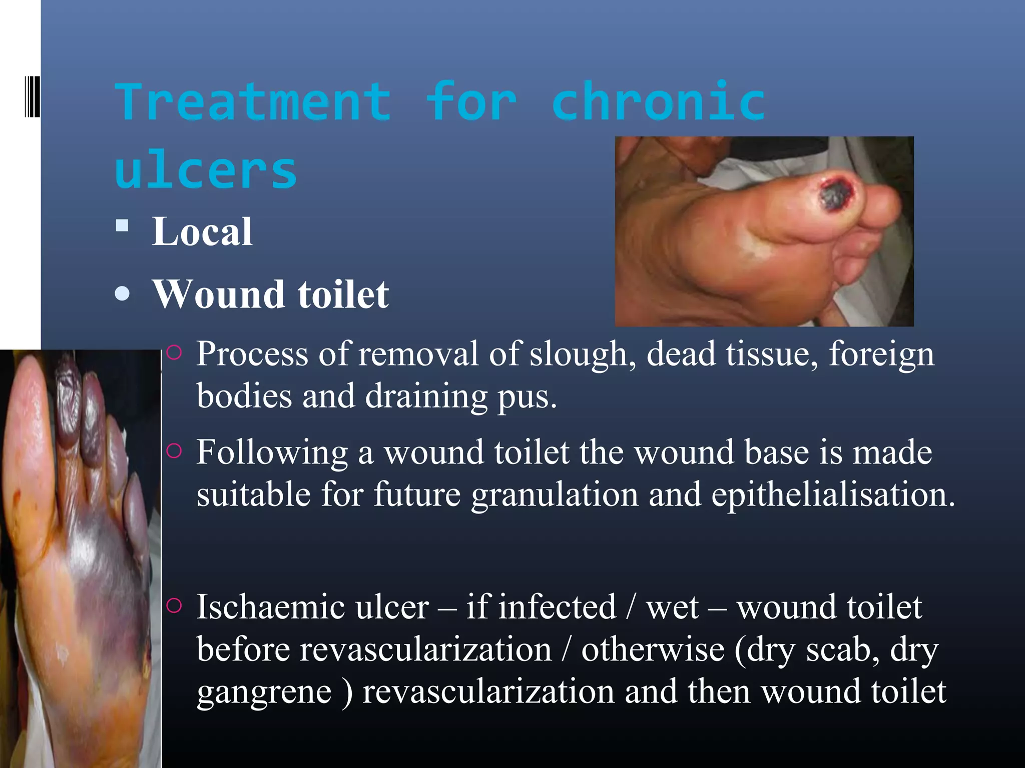 Arterial ulcers by joel arudchelvam | PPT