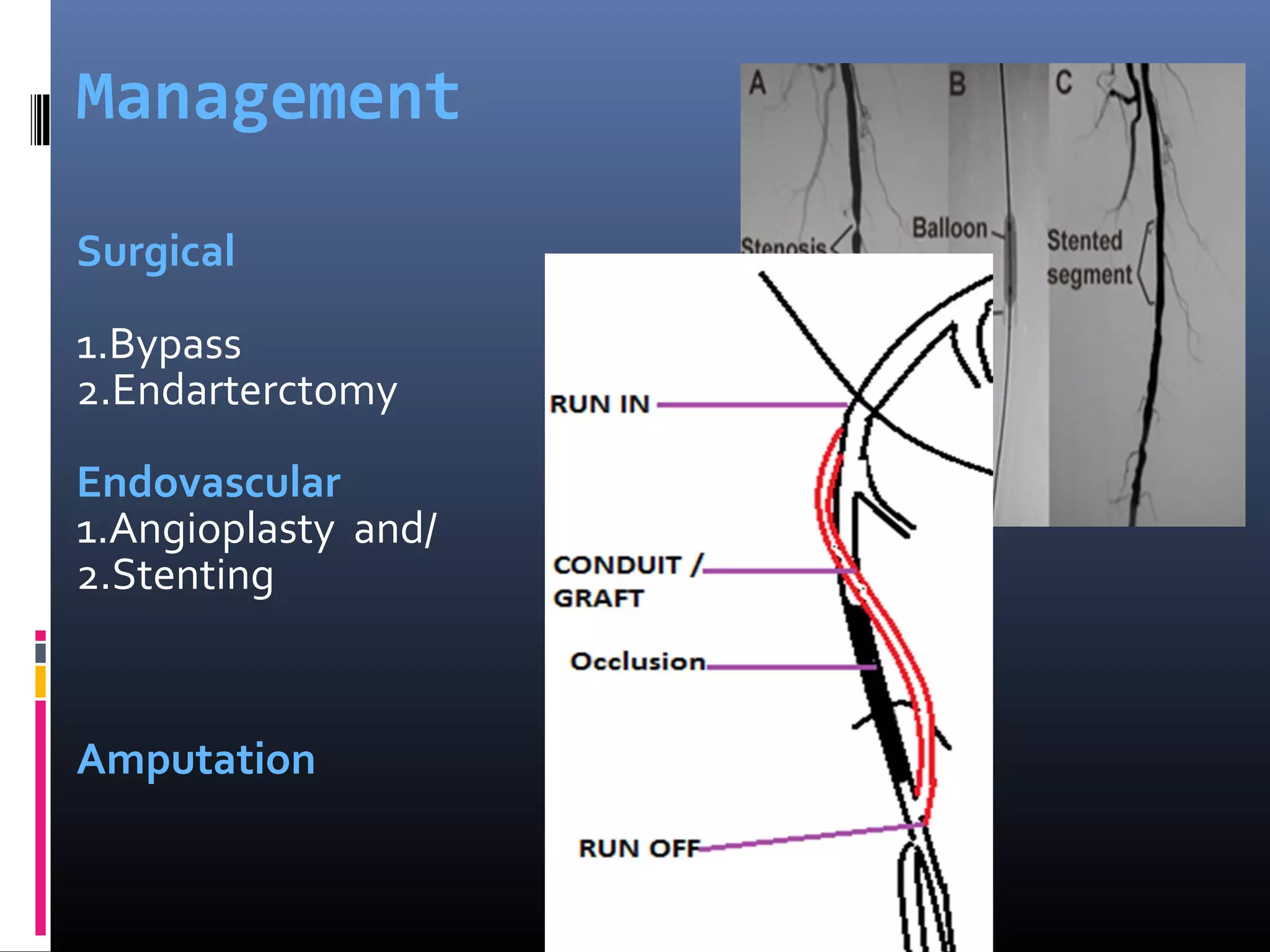 Arterial ulcers by joel arudchelvam | PPT