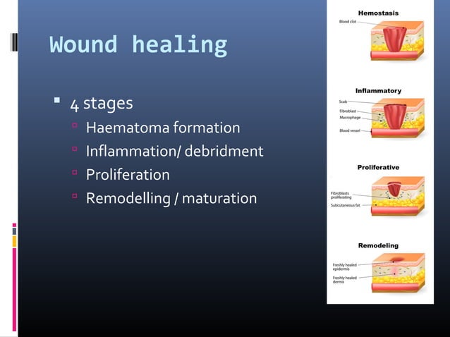 Arterial ulcers by joel arudchelvam | PPT | Skin and Dermatology ...