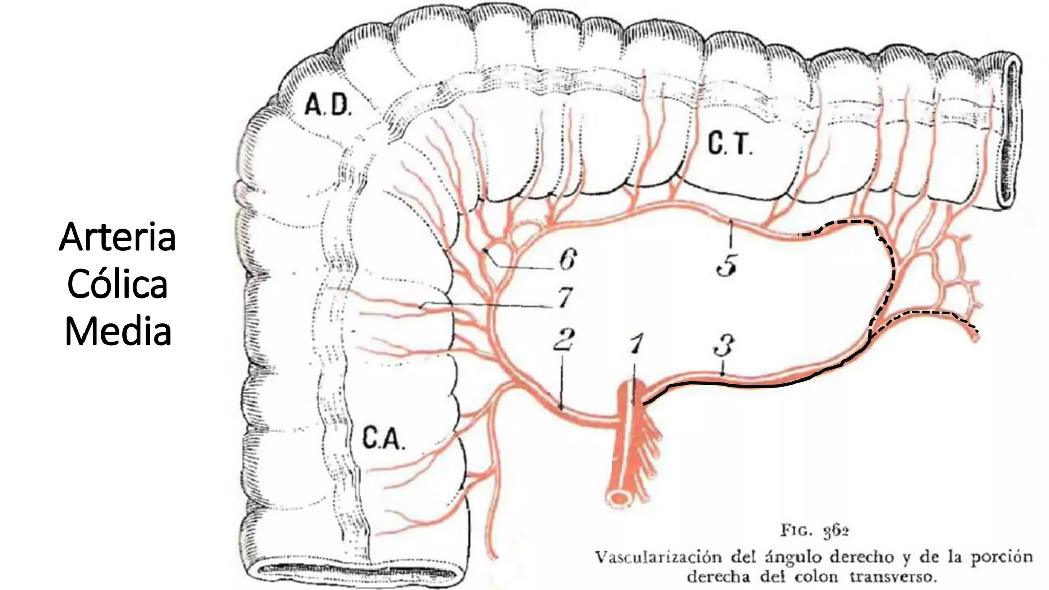 Anatomía - Arteria mesentérica superior (Arterias Cólicas, Arco de ...