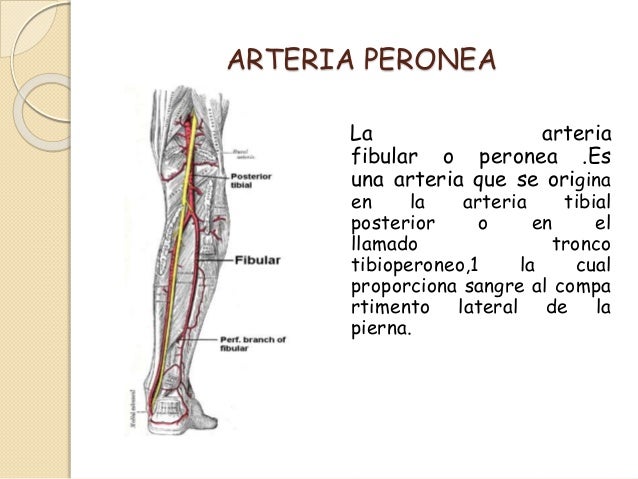 Arterias