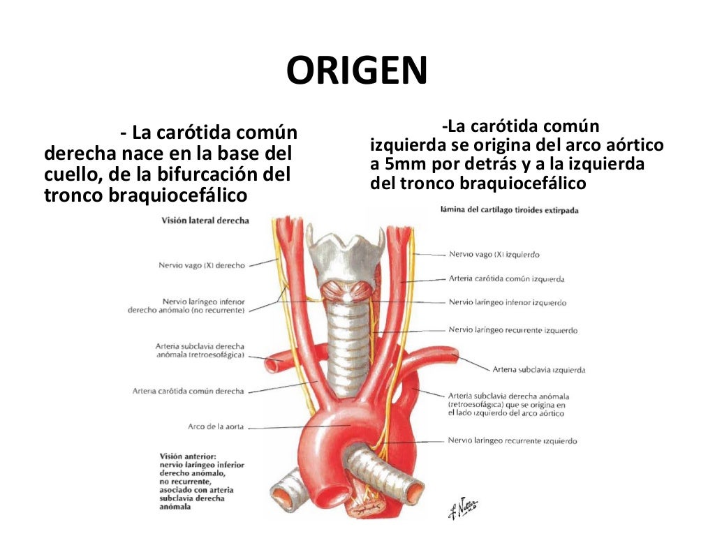 Arterias carótidas comunes