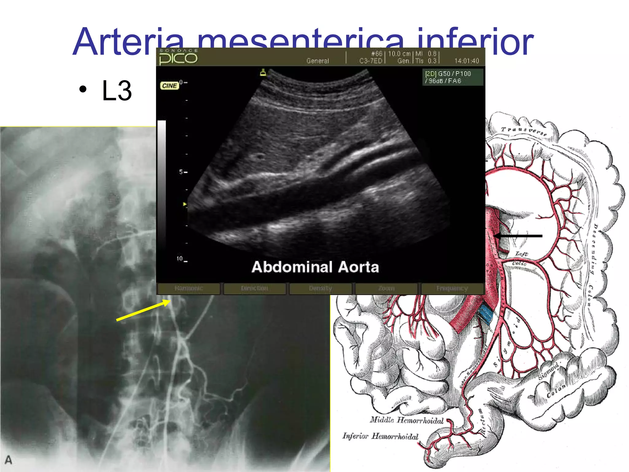 Arteries of human body - Arterije tela | PPT