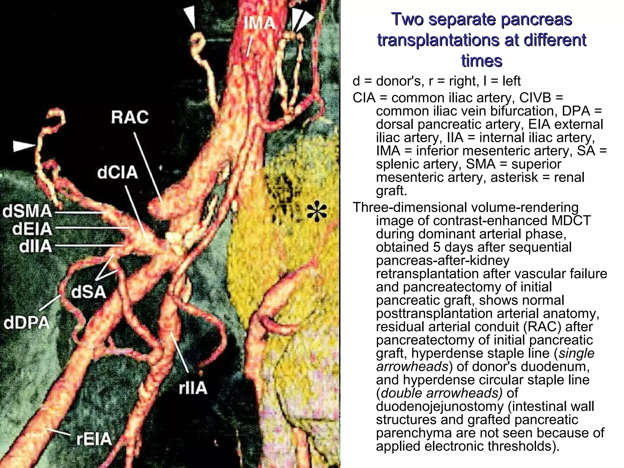 Arteries of human body - Arterije tela | PPT