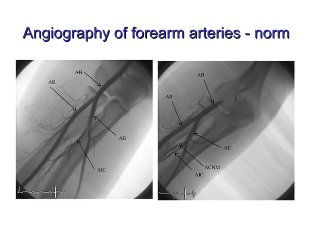 Arteries of human body - Arterije tela | PPT