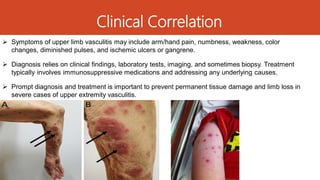 ARTERIES OF THE UPPER LIMB PPT ANATOMY PDF | PDF