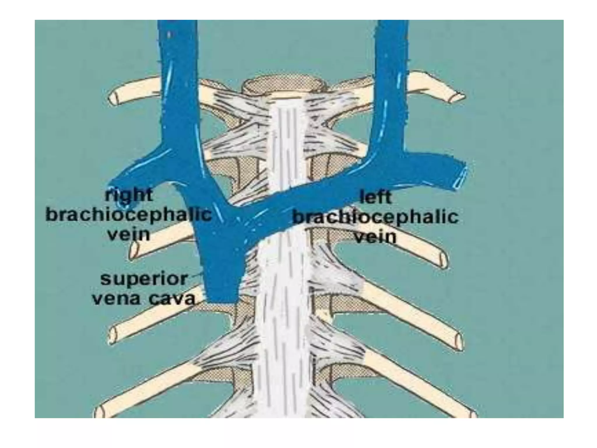 Arteries & veins of the upper body | PPTX