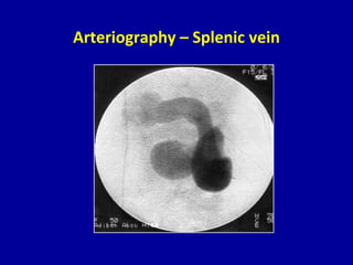 Arterio-Portal Fistula Syndrome (APFS) | PPTX