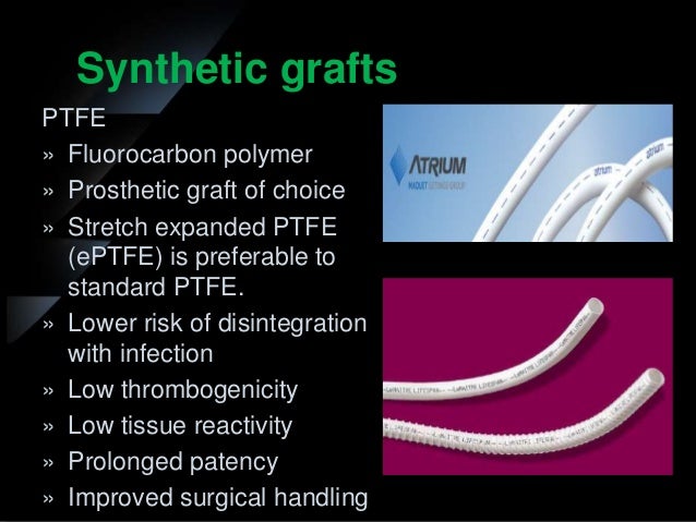 Arterio venous fistulae using grafts