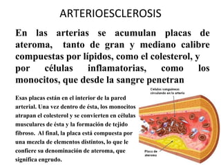 Pasos De Formación De Placa De Aterosclerosis