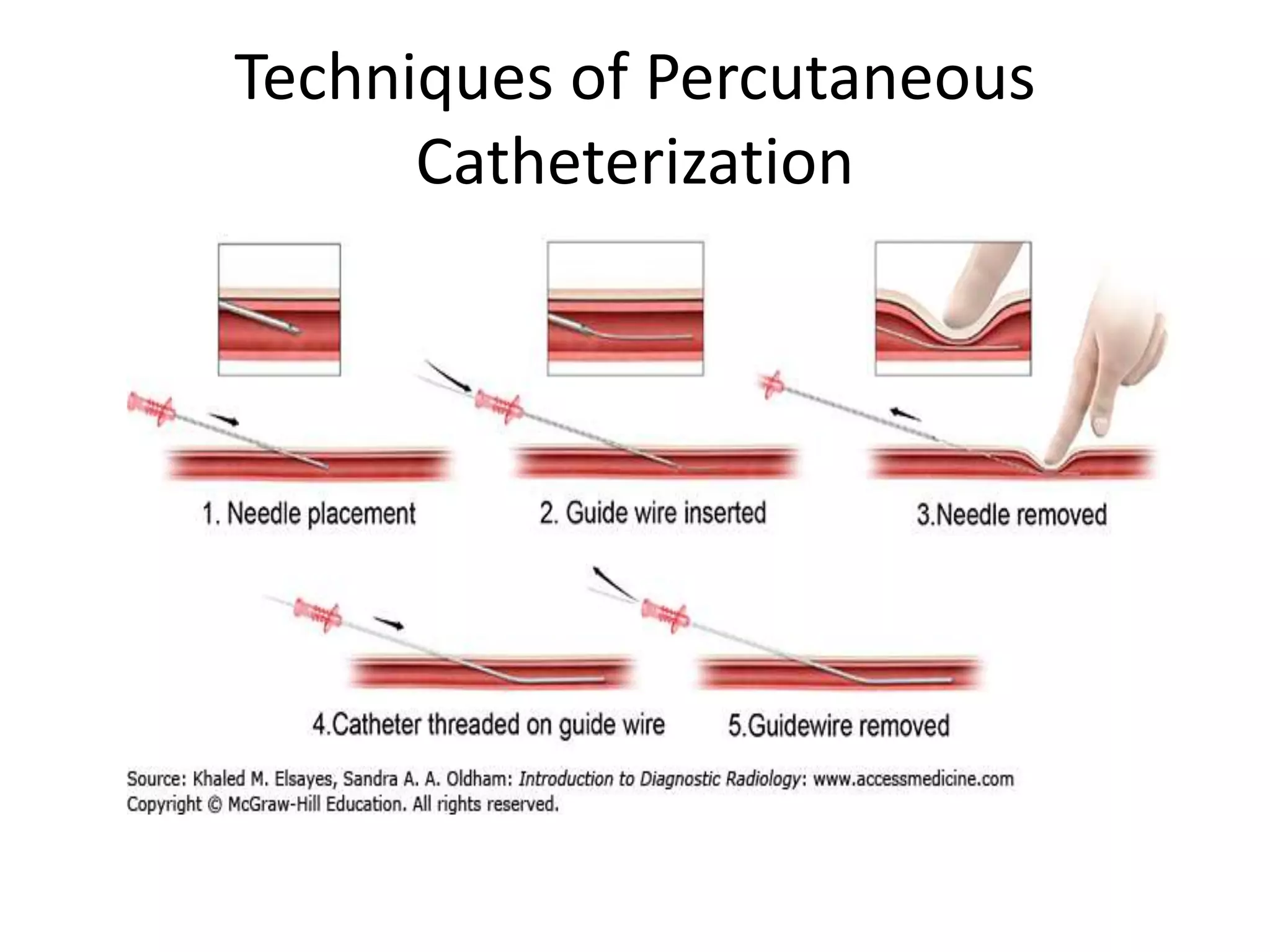 Arteriography and interventional radiology | PPTX