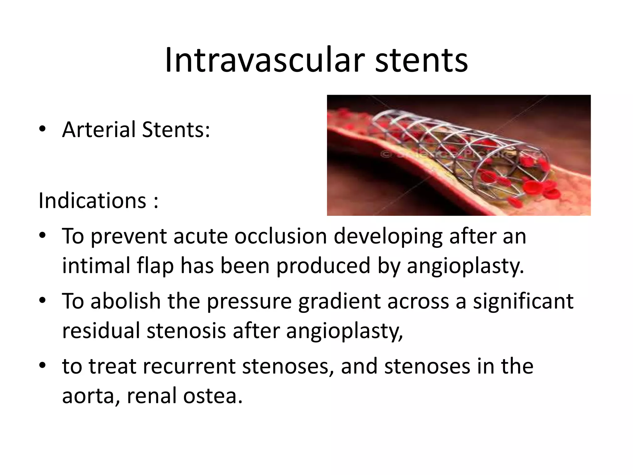 Arteriography and interventional radiology | PPTX