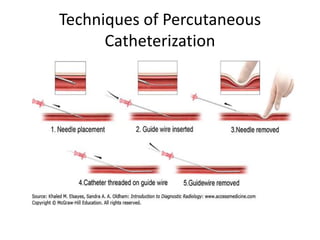 Arteriography and interventional radiology | PPTX