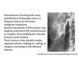 Arteriography and interventional radiology | PPTX