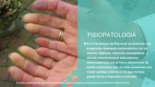 Arteriopatias funcionales | PPTX