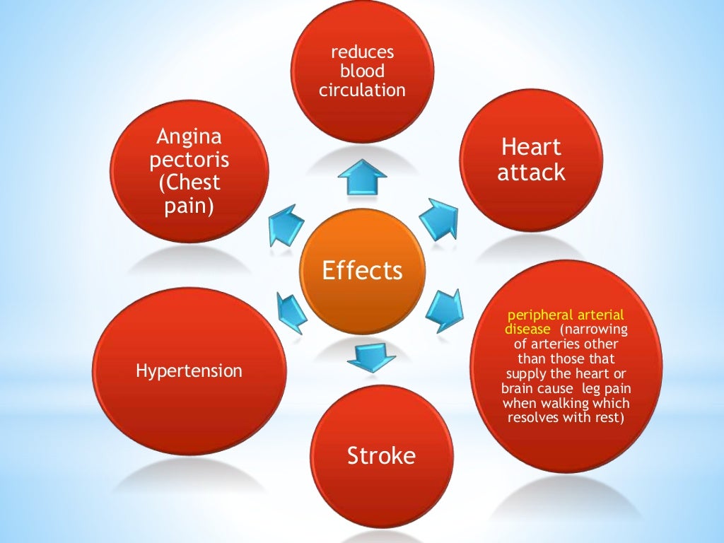 Arteriosclerosis