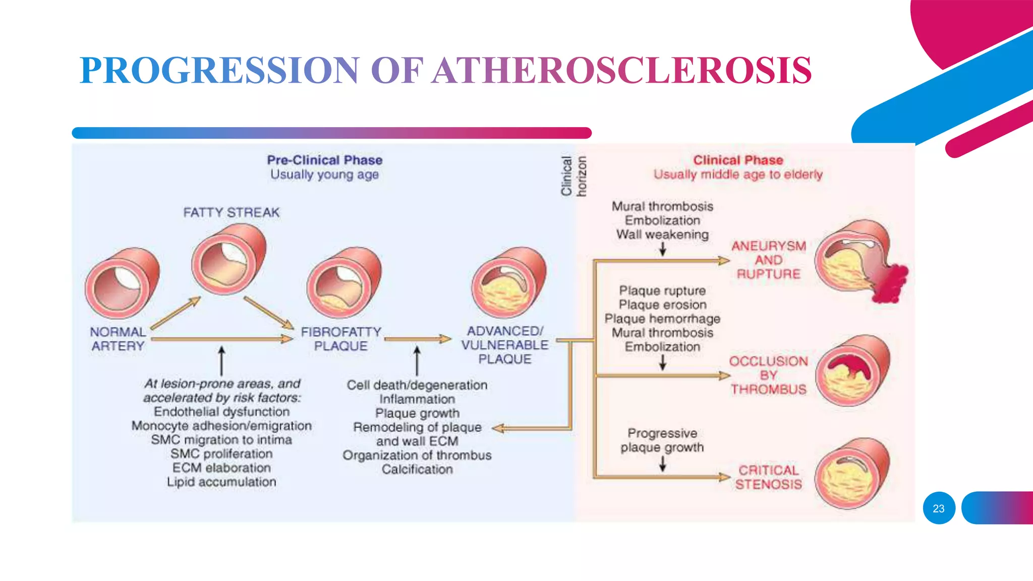 ARTERIOSCLEROSIS.pptx