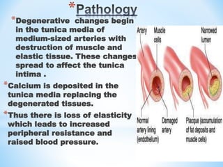 Arteriosclerosis.ppt