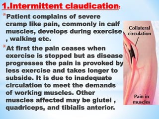 Arteriosclerosis.ppt