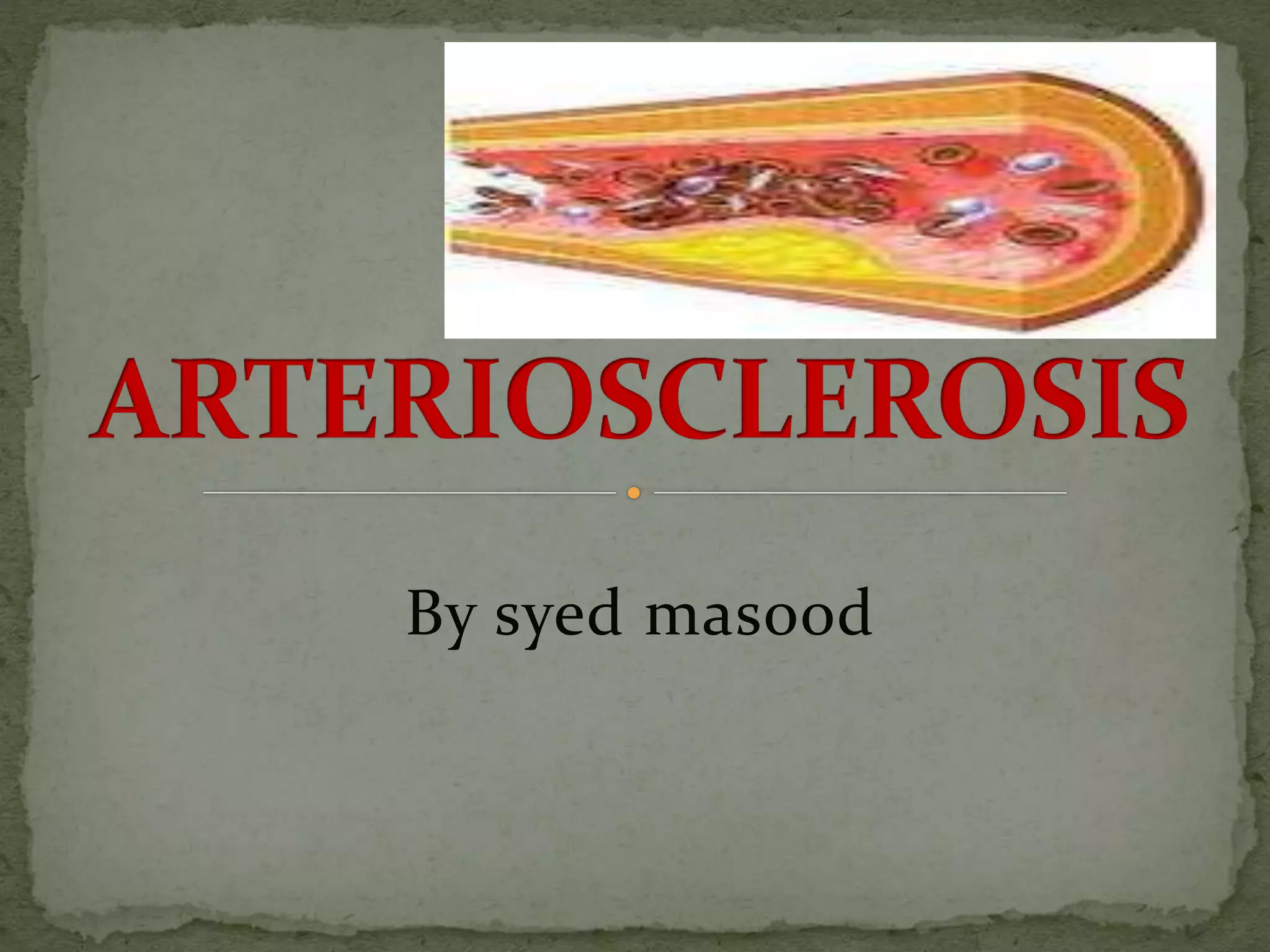 ARTERIOSCLEROSIS.pptx