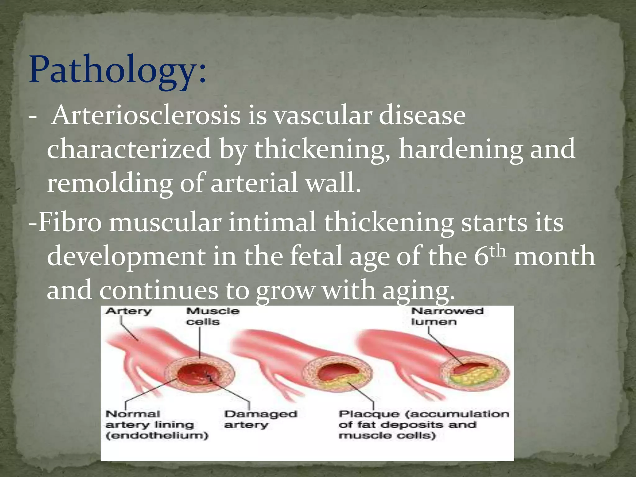 ARTERIOSCLEROSIS.pptx