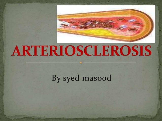 ARTERIOSCLEROSIS.pptx | Heart and Cardiovascular Diseases | Diseases ...