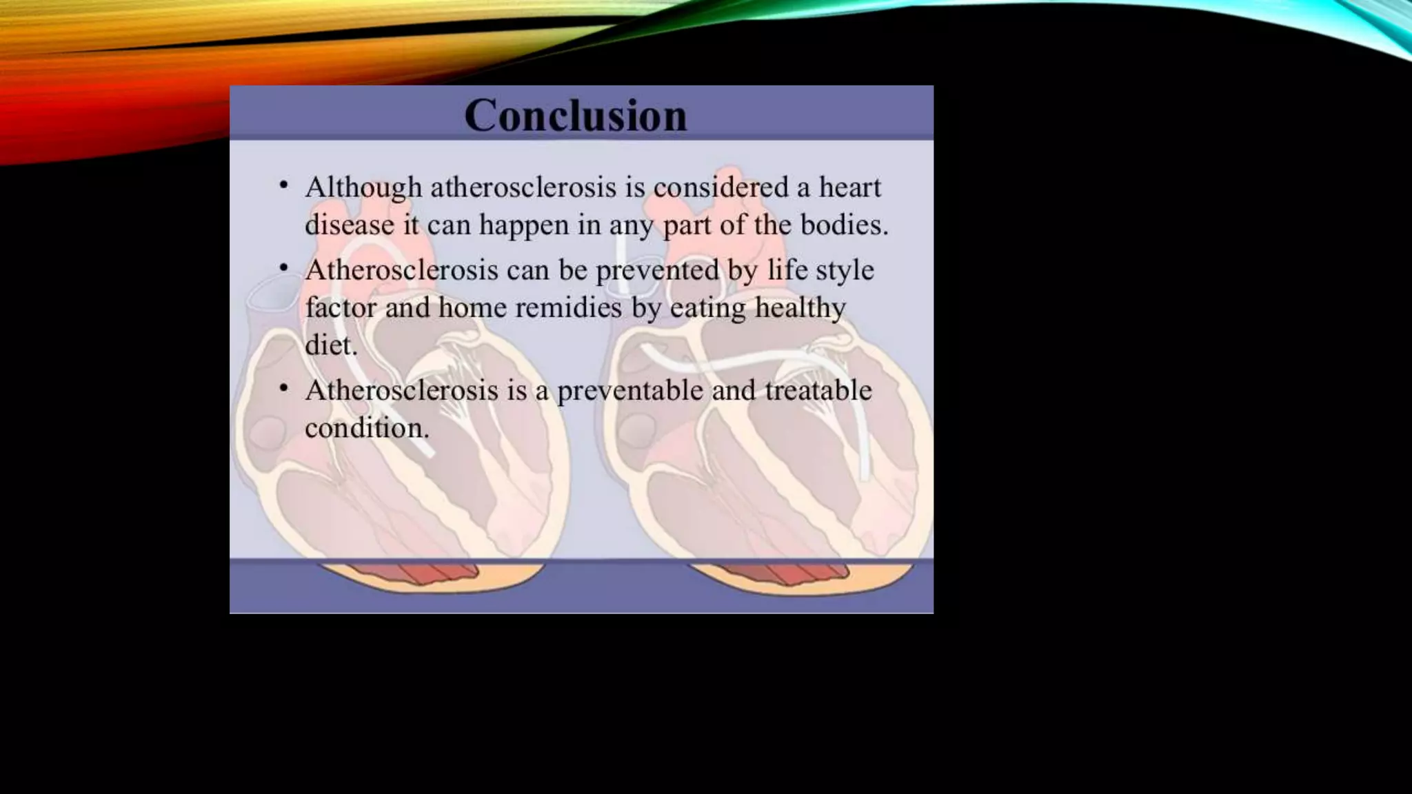 Arteriosclerosis 5 5-2014 lect 3 | PPTX