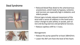 Arterio venous fistula - Reg Lagaac (Cambridge) | PPTX