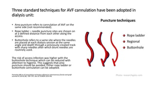 Arterio venous fistula - Reg Lagaac (Cambridge) | PPTX