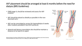 Arterio venous fistula - Reg Lagaac (Cambridge) | PPTX