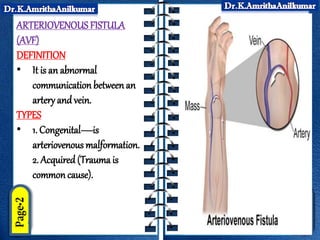 Congenital Av Fistula