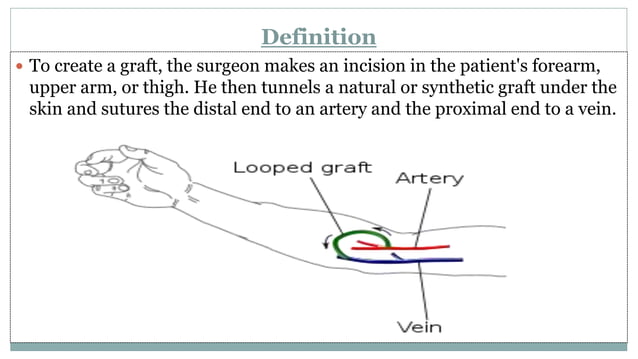 Arteriovenous graft | PPTX | Blood Disorders | Diseases and Conditions
